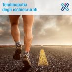 Tendinopatia Ischiocrurali I Tipologie e Trattamento